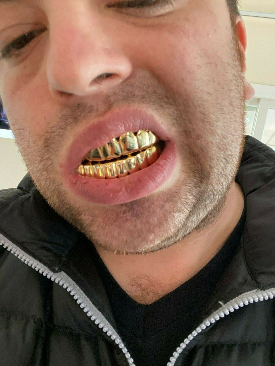 Iced Out Gold and Silver Teeth Grillz | Harlem Bling – Harlembling